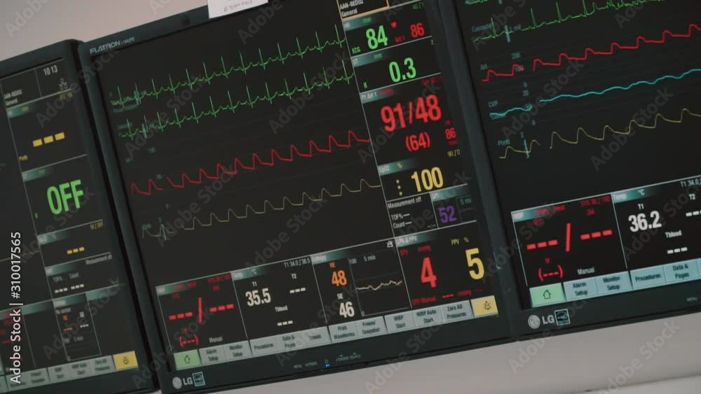 Modern medical pre-operation room in which doctors look into monitors ...