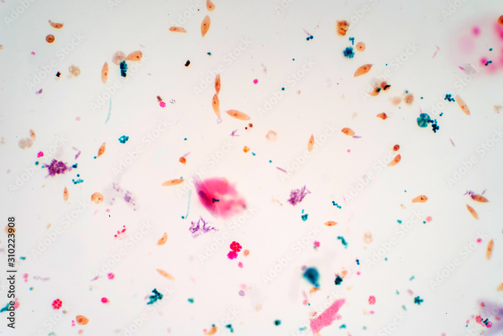 Mixed of protozoa under microscoope view for education biology. Stock ...