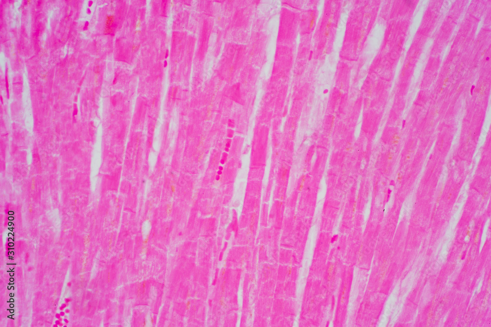 Histology of human cardiac muscle under microscope view for education ...