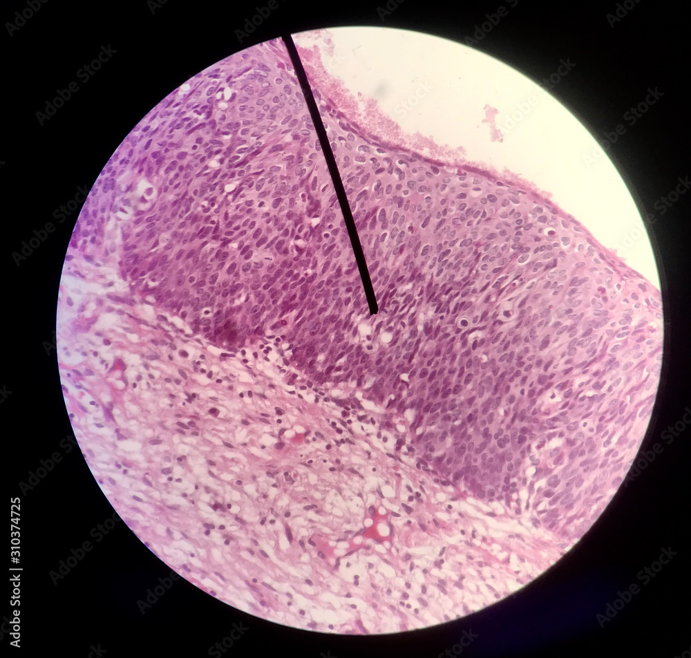Cells in reproductive female cytology and histology concept. Stock ...