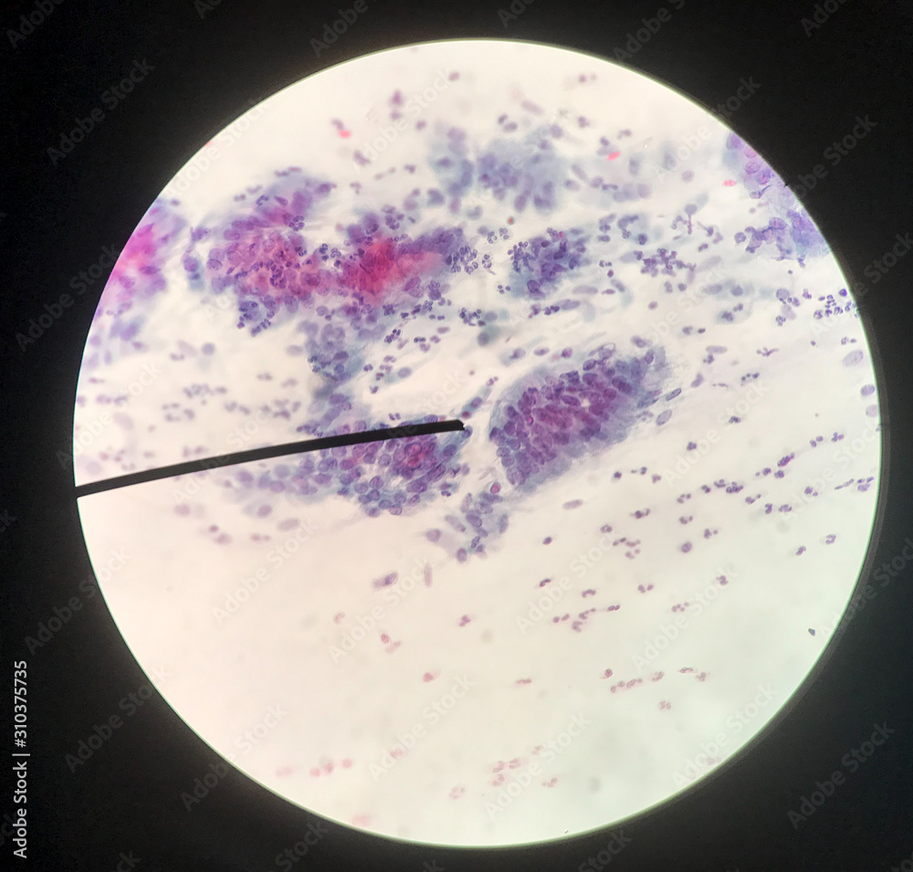Cells in reproductive female cytology and histology concept. Stock ...