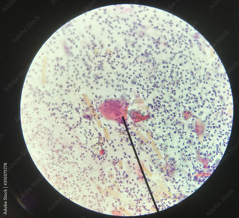 Cells in reproductive female cytology and histology concept. Stock ...