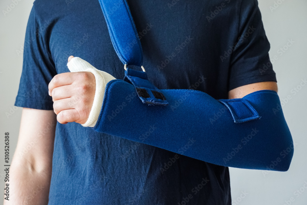 Man with plaster cast on broken thumb,broken wrist, broken hand on arm ...