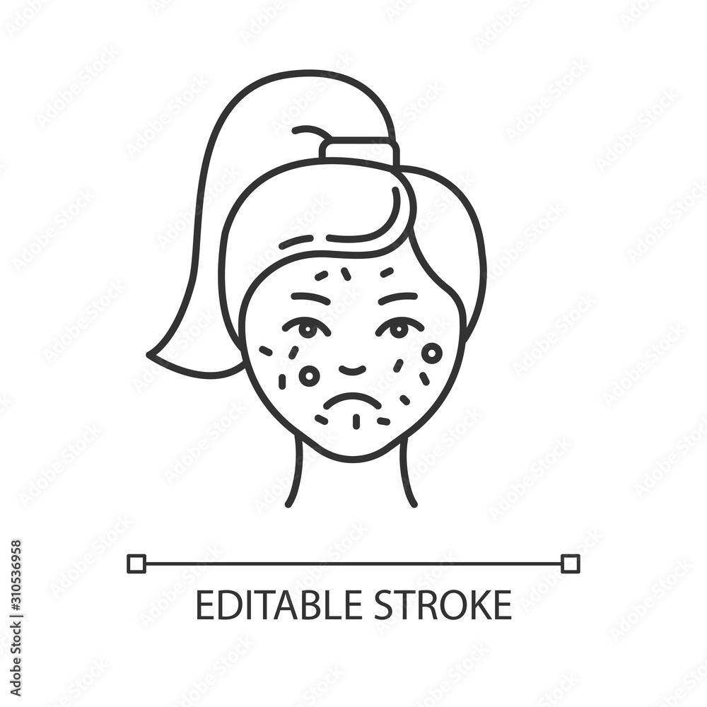 Acne linear icon. Pimples on female face. Skincare for inflammation ...