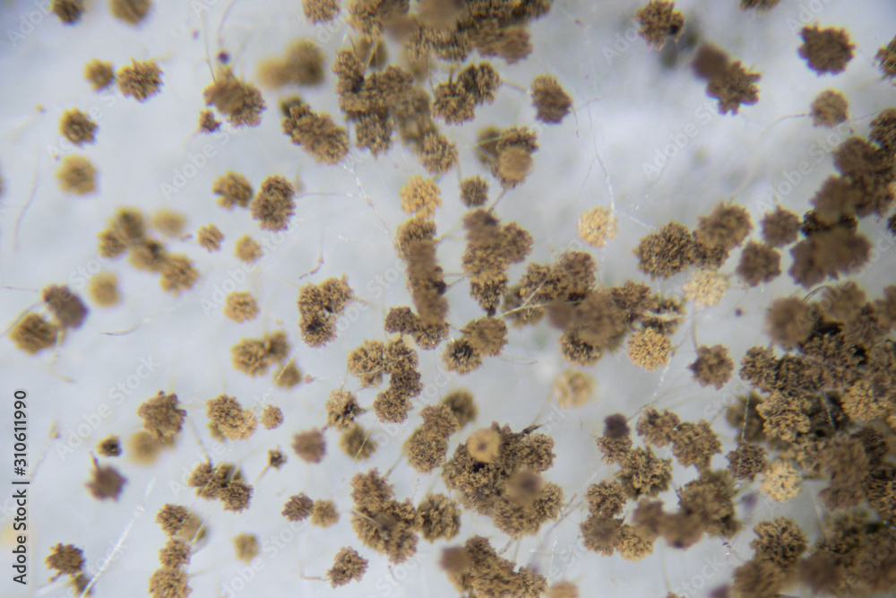 Backgrounds Colony Characteristics of Rhizopus (bread mold) is a genus ...