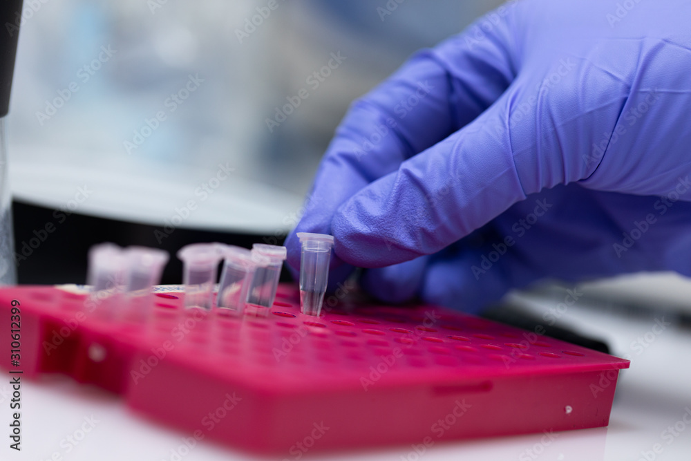 Polymerase Chain Reaction (PCR) and Agarose gel electrophoresis is a ...