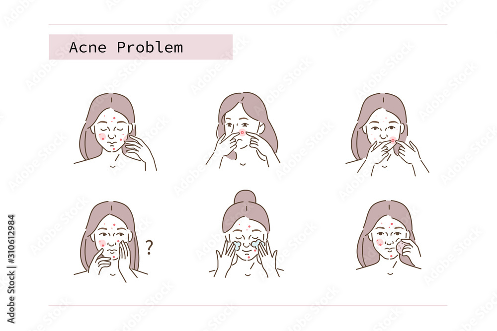 Beauty Girl Have Acne Skin Problems. Woman Squishing Pimples on Face ...