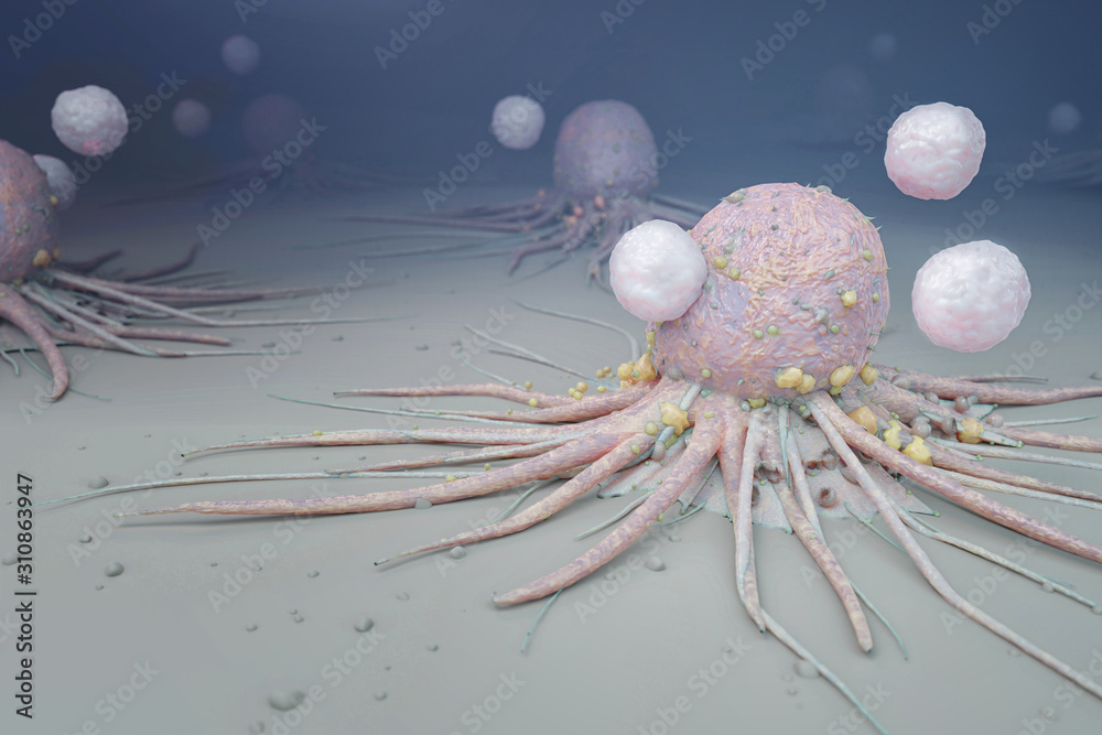 Immune System White Blood Cells attacking Cancer Cells, 3d illustration ...