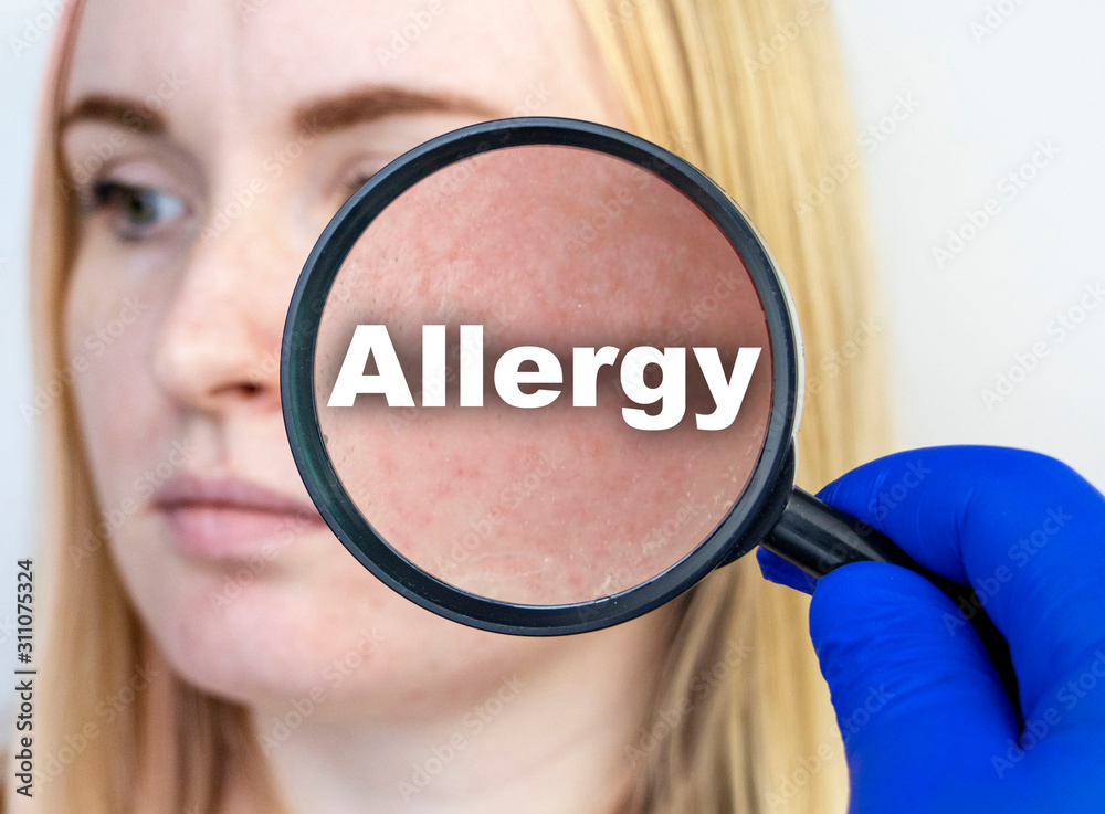 Allergy and rash close-up. A woman is being examined by a doctor ...