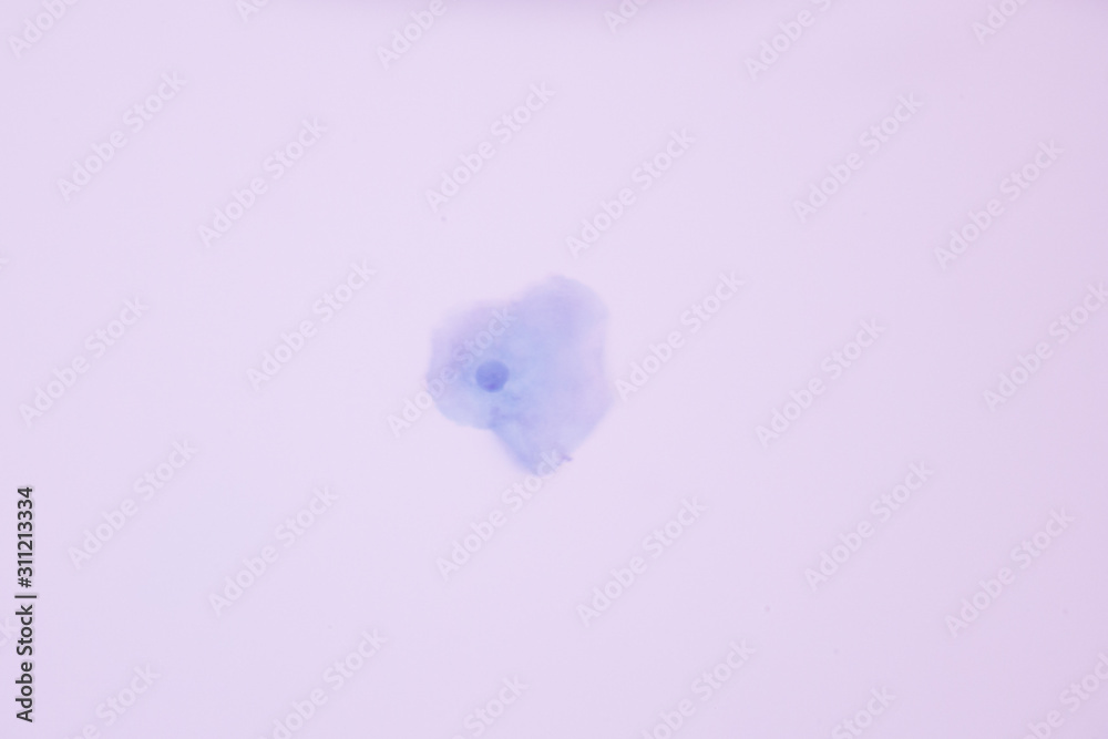 View in microscopic of normal human cervix cells.Squamous epithelium ...