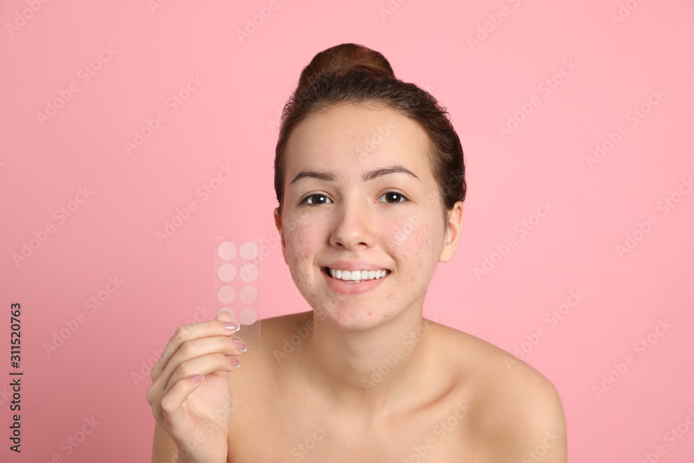 Teen girl holding acne healing patches on light pink background Stock ...