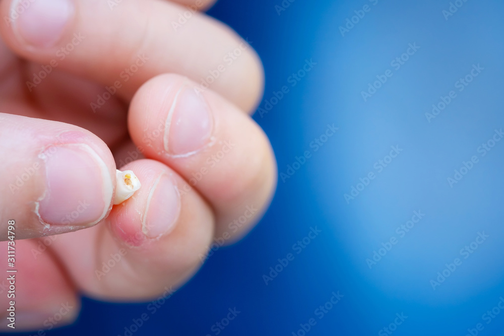 Asia little young boy lost his first milk tooth and showing his first milk tooth on his hand ...