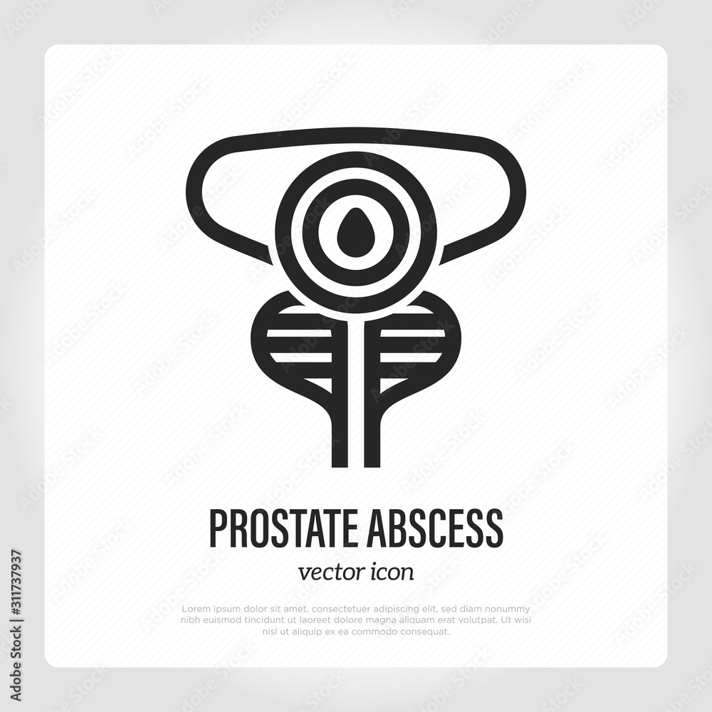 Prostate abscess thin line icon. Acute pain and inflammation. Bacterial ...