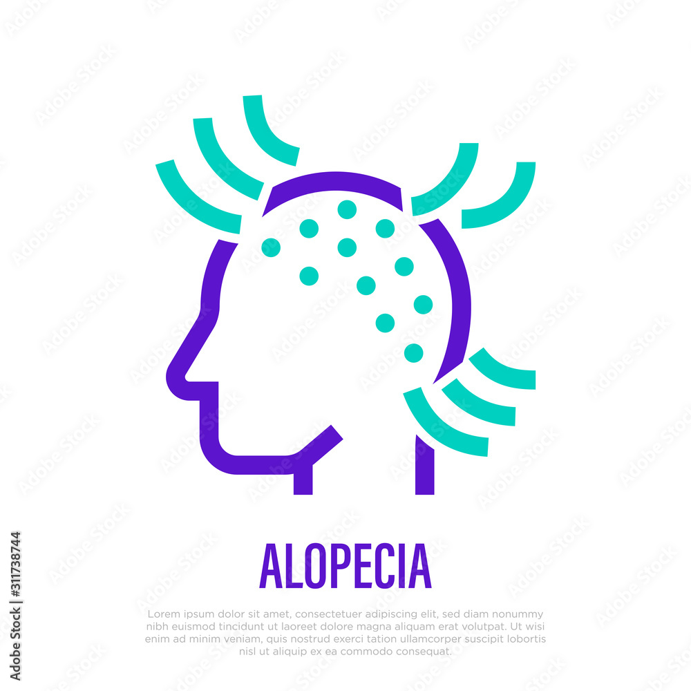 Alopecia thin line icon. Hair loss. Bald place on scalp. Vector ...