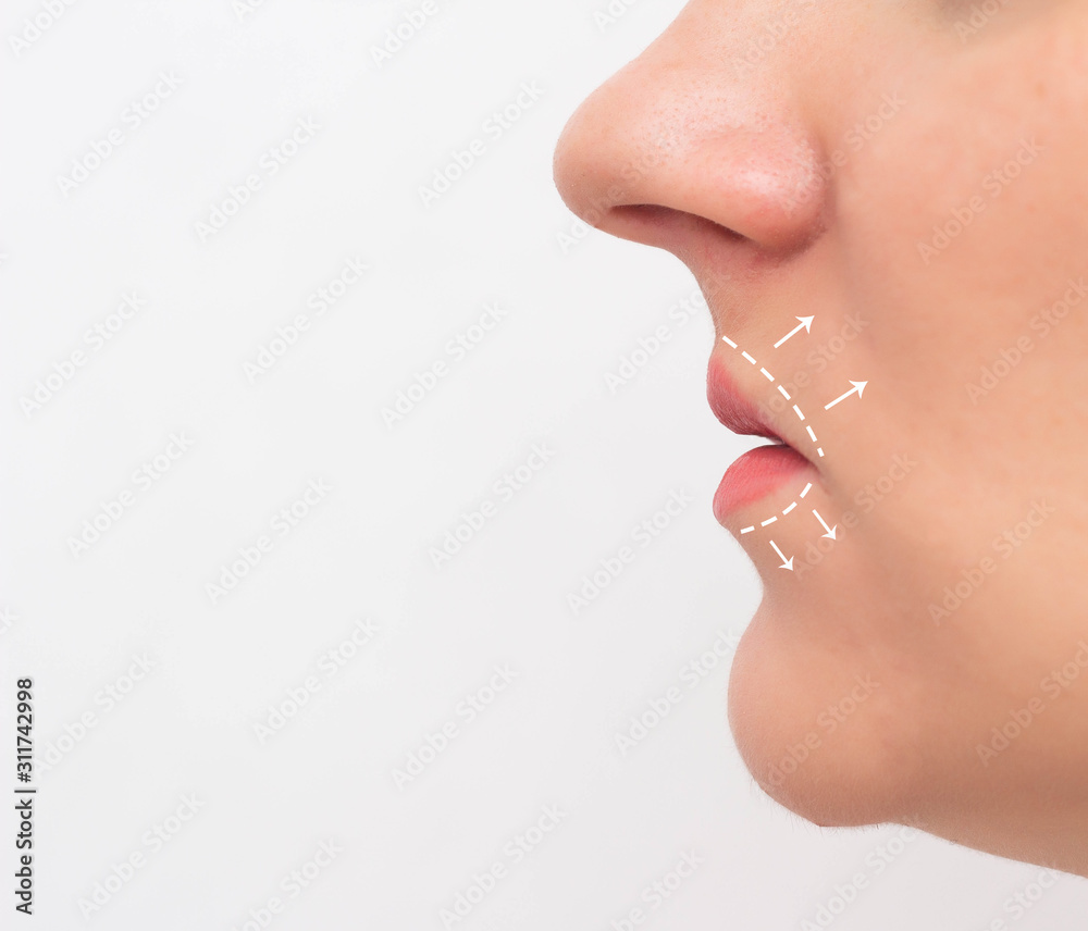 Girl's face with painted lips and white markers on the lips. The ...