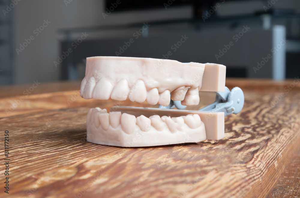 Teeth printed by 3d printer. Upper and lower jaw of adult. Used to ...