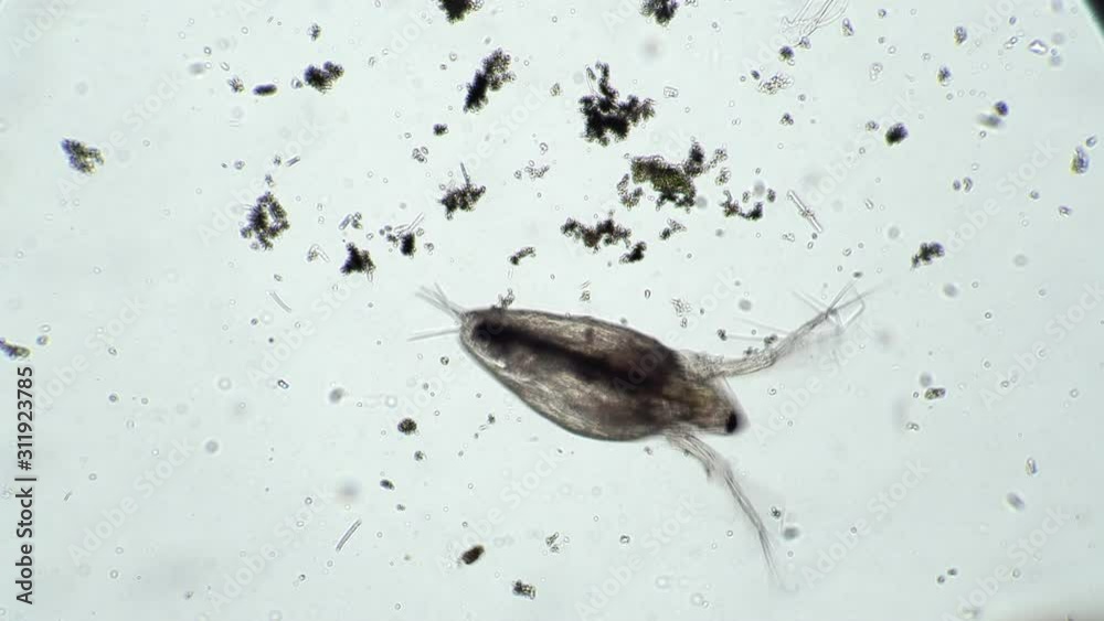 Daphnia floats in muddy pond water in microscope. Transparent ...