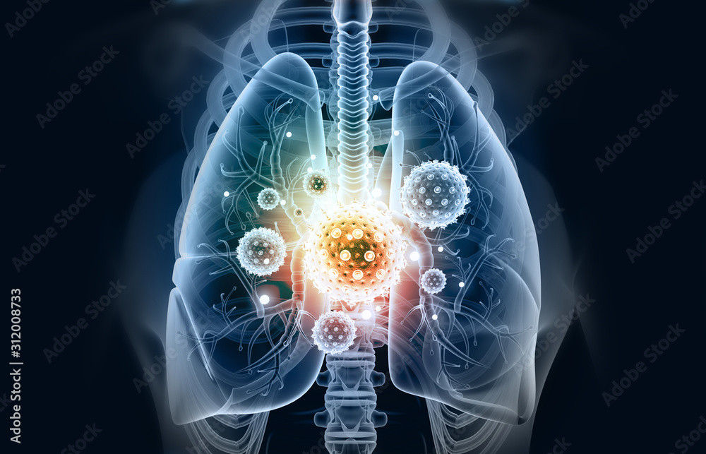 Human lungs infected by virus and bacteria. Lungs Anatomy. 3d ...