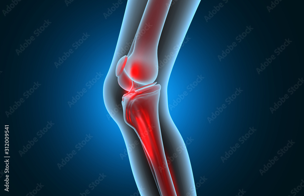 Anatomy of human knee. knee pain. 3d illustration. Stock Illustration ...