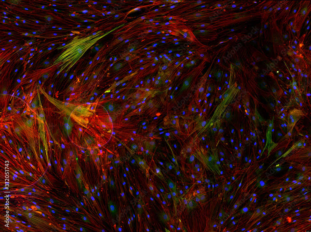 Foto de Real fluorescence microscopic view of human cells - human lung ...