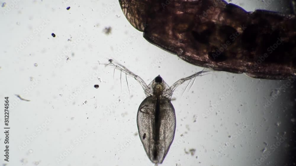 Vídeo do Stock: Defecation of daphnia pond close-up in microscope ...