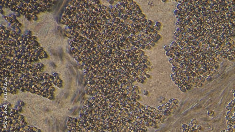 Microscopy of yeast cells (Saccharomyces cerevisiae). Magnification ...