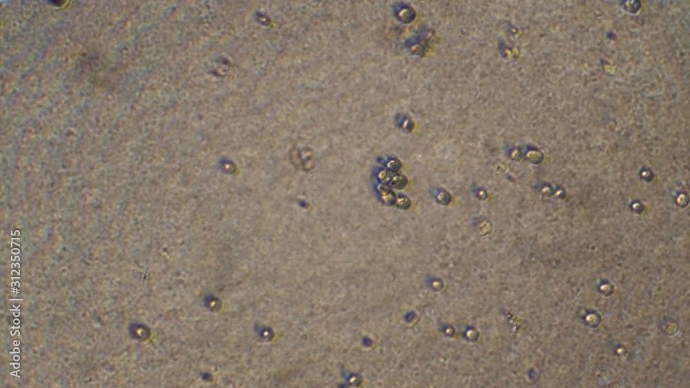 Microscopy of yeast cells (Saccharomyces cerevisiae). Magnification ...