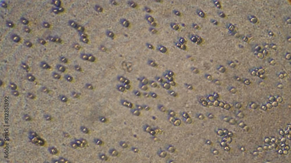 Microscopy of yeast cells (Saccharomyces cerevisiae). Magnification ...