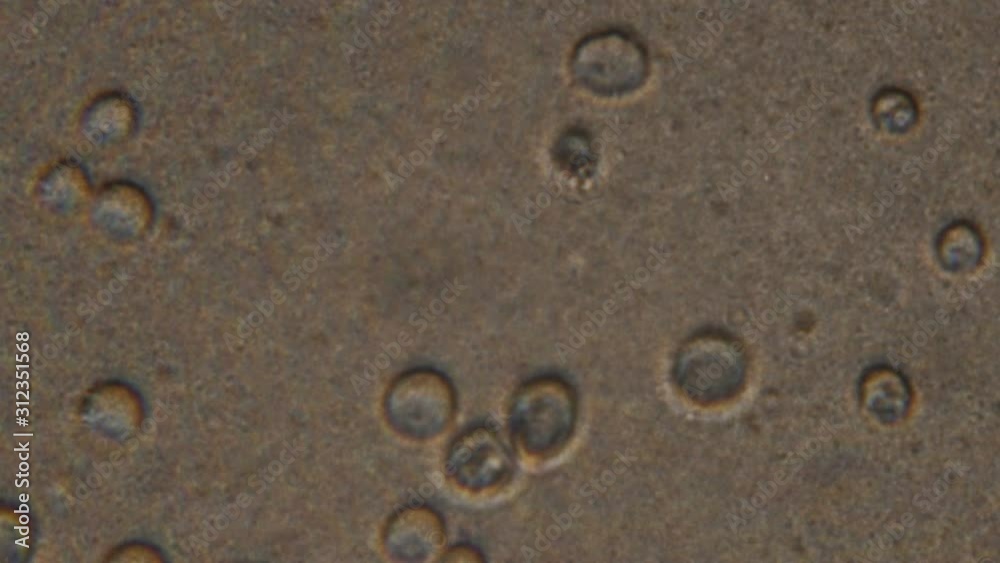 Microscopy of yeast cells (Saccharomyces cerevisiae). Magnification ...