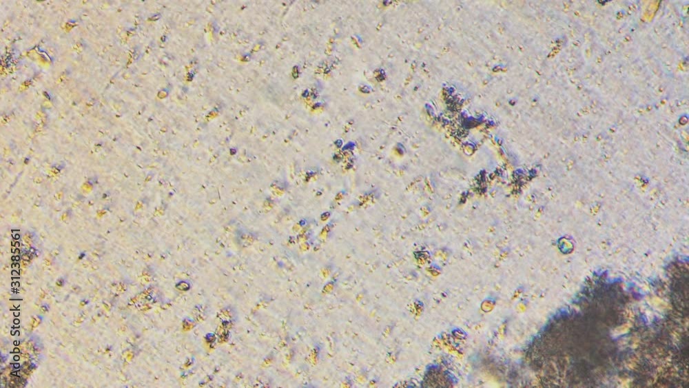Microscopy of multiple colonies of protozoa and bacteria in the water ...
