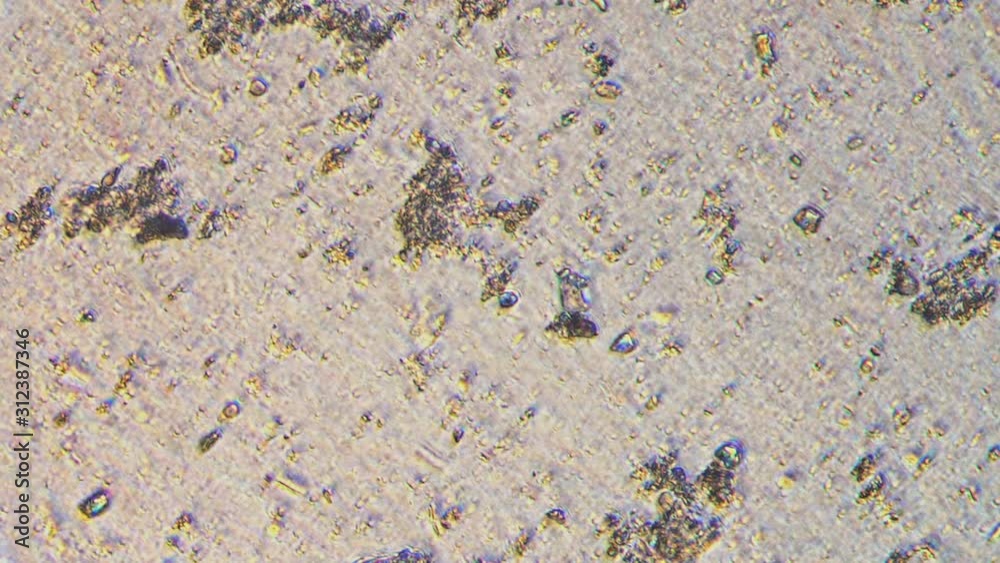 Microscopy of multiple colonies of protozoa and bacteria in the water ...
