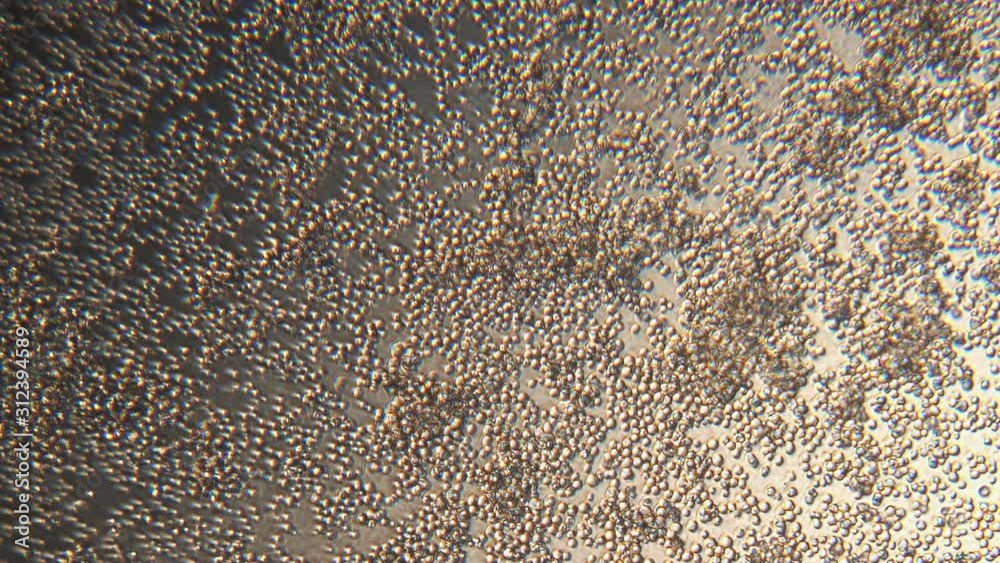 Microscopy of yeast cells (Saccharomyces cerevisiae). Magnification ...