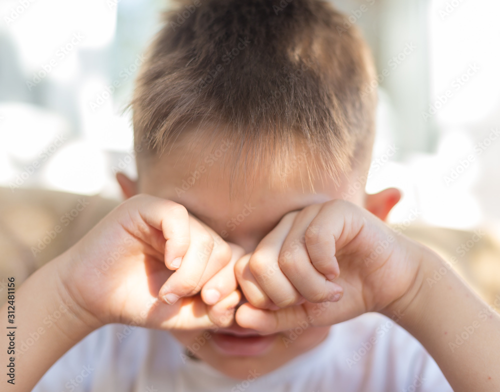 Good morning. Cute boy woke up with a swollen face Stock Photo | Adobe ...