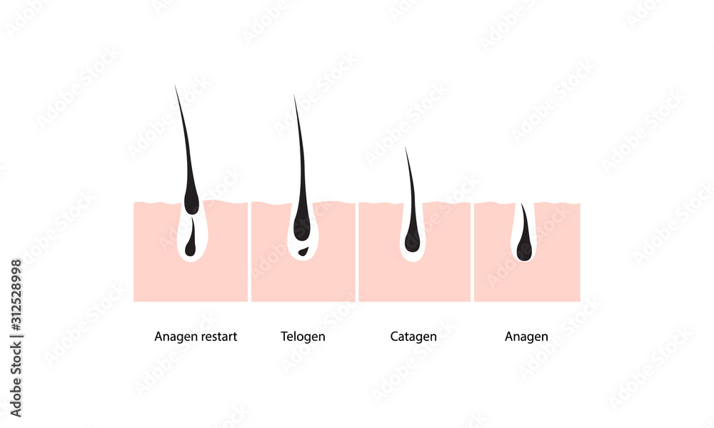 Hair growth cycle skin. vector illustration Stock Vector | Adobe Stock