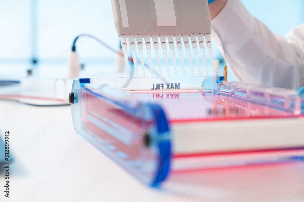 Loading Samples and Running an Agarose Gel for electrophoresis, Gel ...