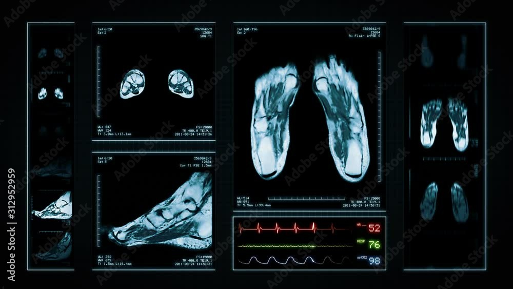 Foot MRI Scan. Blue. 3 videos in 1 file. Animation showing top, front ...