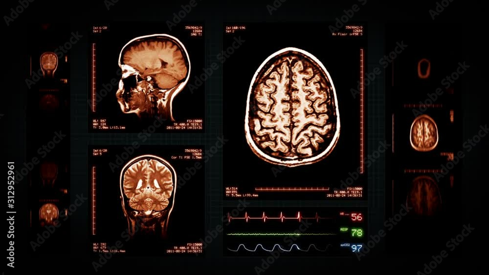 Brain MRI Scan. Amber. 4 videos in 1 file. Animation showing top, front ...