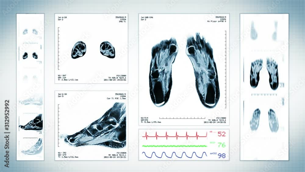 Foot MRI Scan. White. 3 videos in 1 file. Animation showing top, front ...