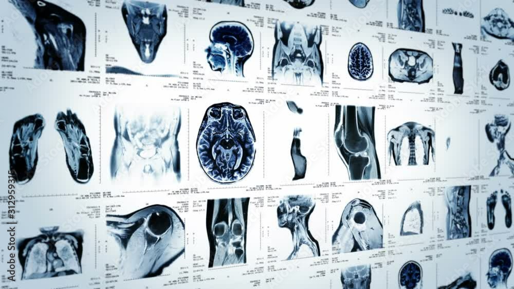 MRI video wall. White and Black. Loopable. Lateral view. 2 videos in 1 ...
