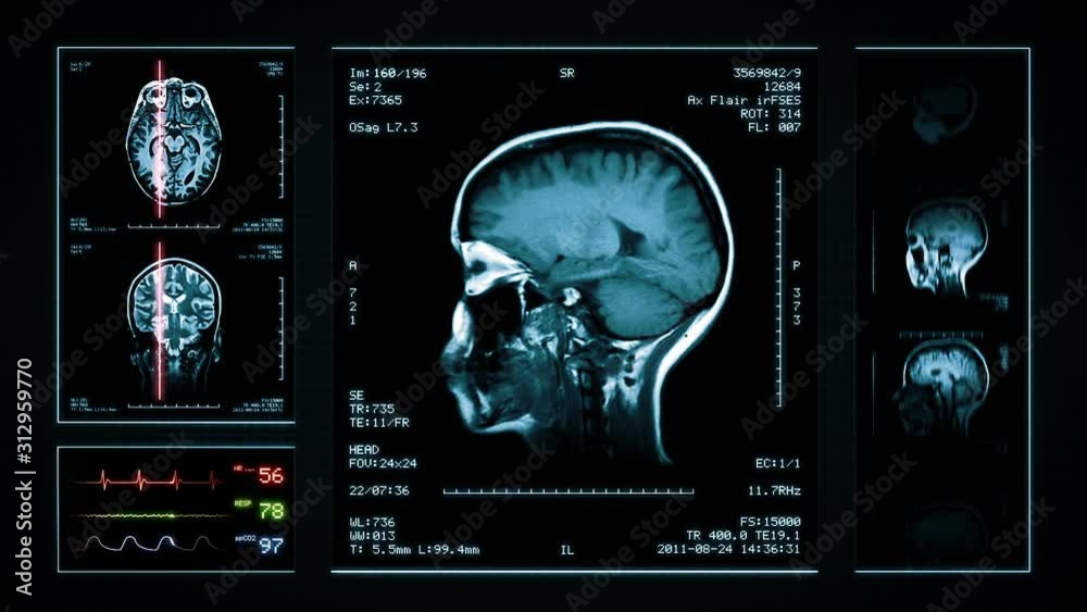 Brain, Knee and Neck MRI Scan. Blue. 3 videos in 1 file. Loopable ...