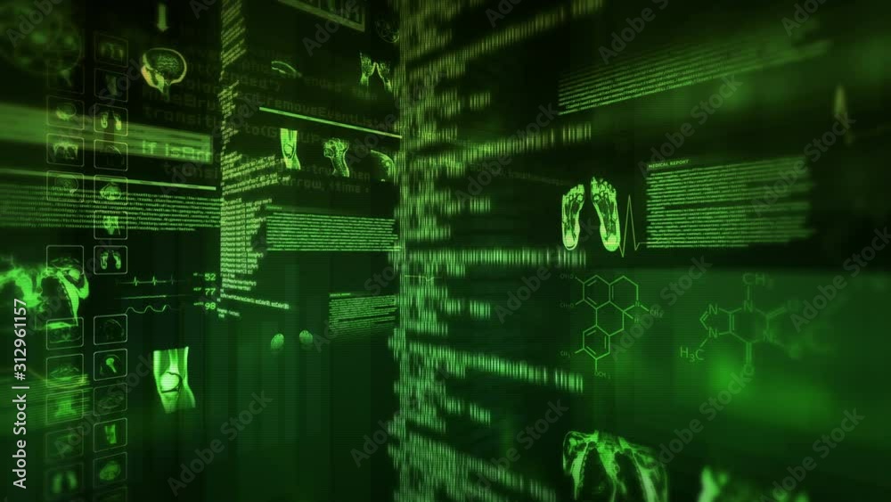 MRI interface. Green. Loopable. Lateral view. 2 videos in 1 file ...