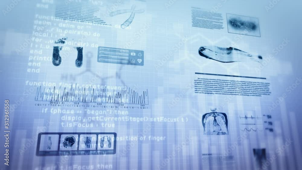 MRI interface. Loopable. Lateral view. 4 videos in 1 file. Multiple MRI ...