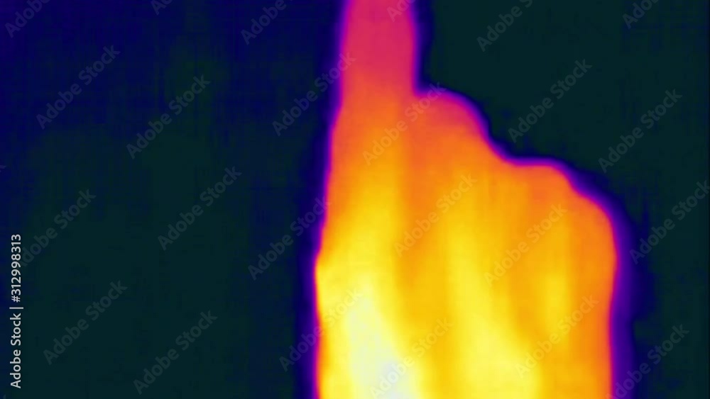 Side View Thermal Infrared Radition Imaging Of Mans Hand Palm Opened Up ...