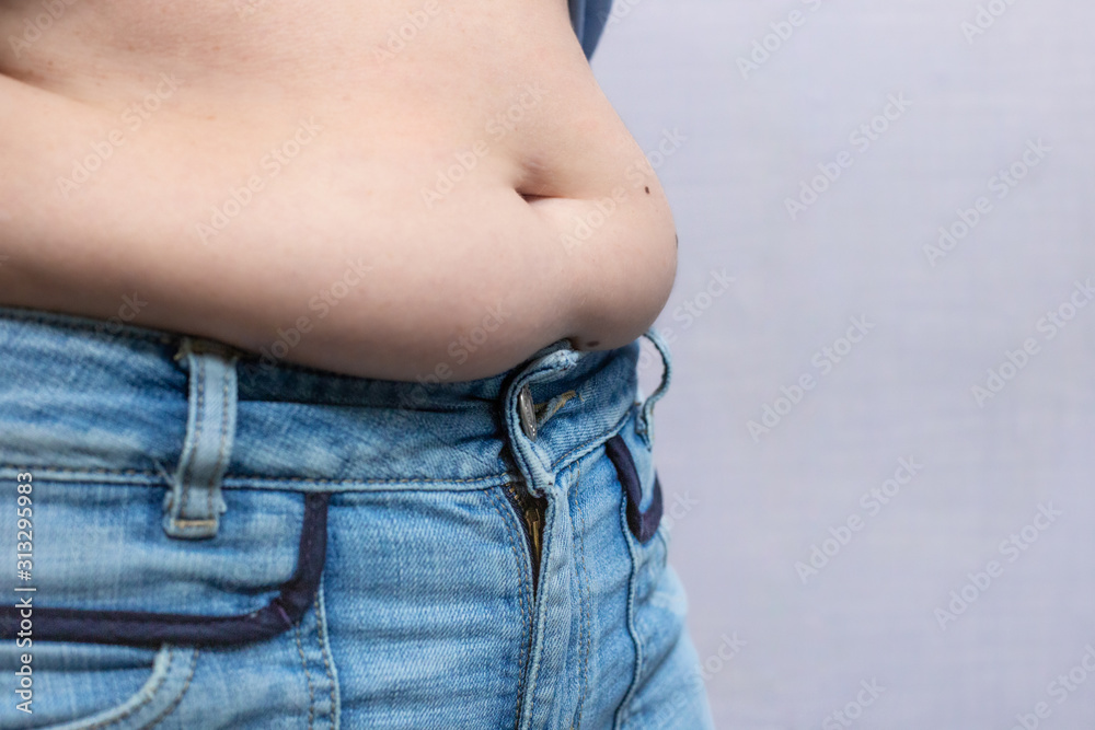 overweight woman, large belly with folds of fat Stock Photo | Adobe Stock