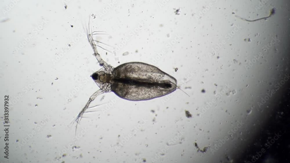 Live crustacean Daphnia in a microscope in slow motion. Theme of ...