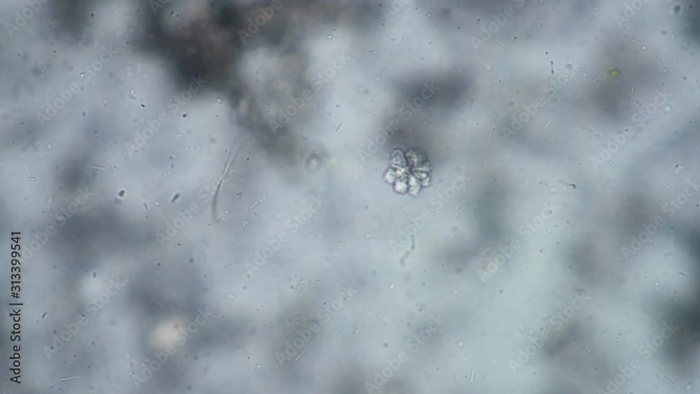 Algae Synura heterokont swim on the surface of the water. Theme of ...