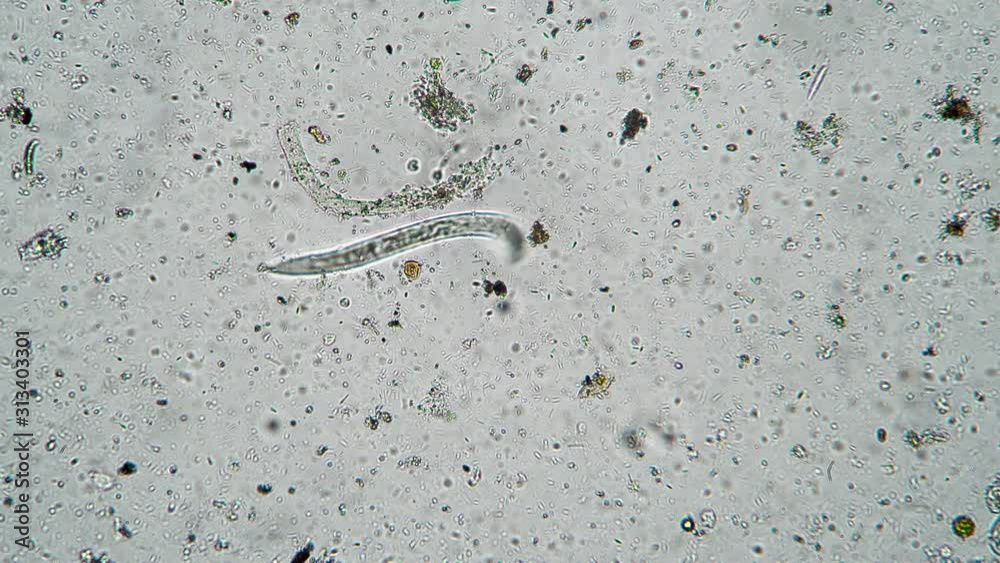 The nematode worm moves among numerous clusters of bacteria and ...