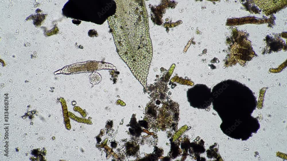 A large rotifer moves among a variety of microorganisms. Theme of ...