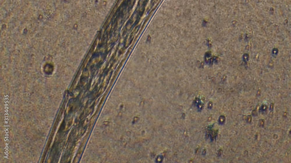 Microscopy of parasite worm nematode (Strongyloides stercoralis ...