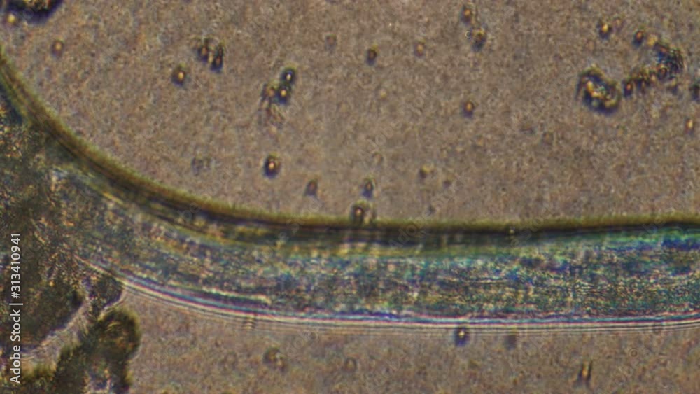 Microscopy of parasite worm nematode (Strongyloides stercoralis ...
